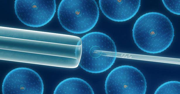 Unproven stem cell therapy has its devotees