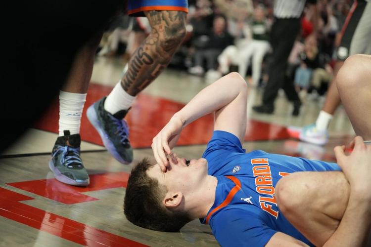Florida's Alex Condon will wear a mouthpiece moving forward following ...