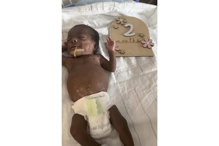 `Micropreemie' baby who weighed just over 1 pound at birth goes home ...