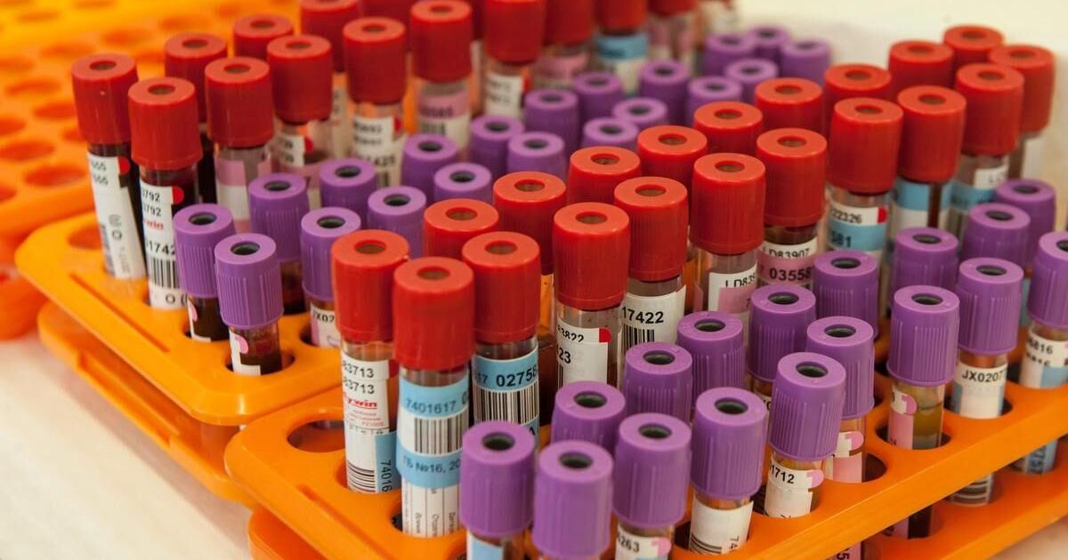 Why are Canadian police using expired blood collection equipment in DUI ...