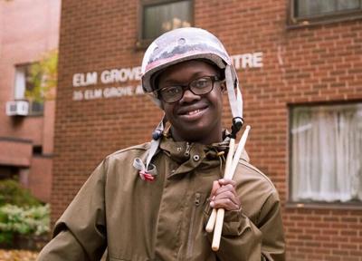 black downs syndrome