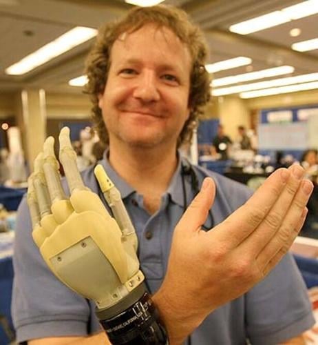 New bionic hands give users stronger grip
