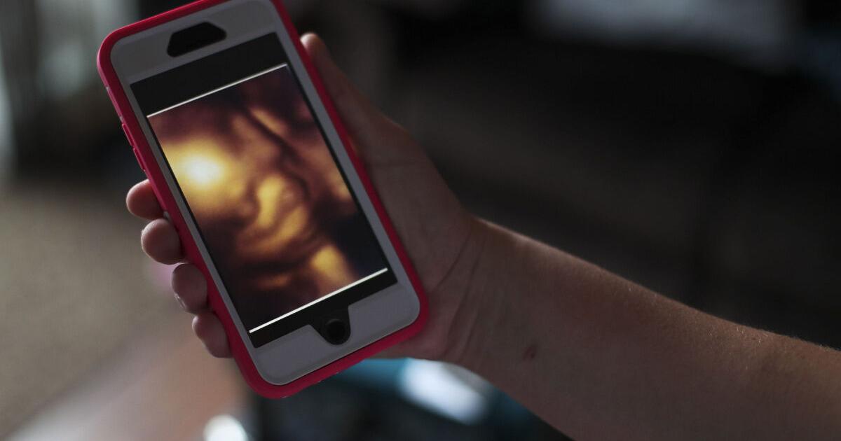Ontario looking into regulating 3D ‘entertainment ultrasounds’