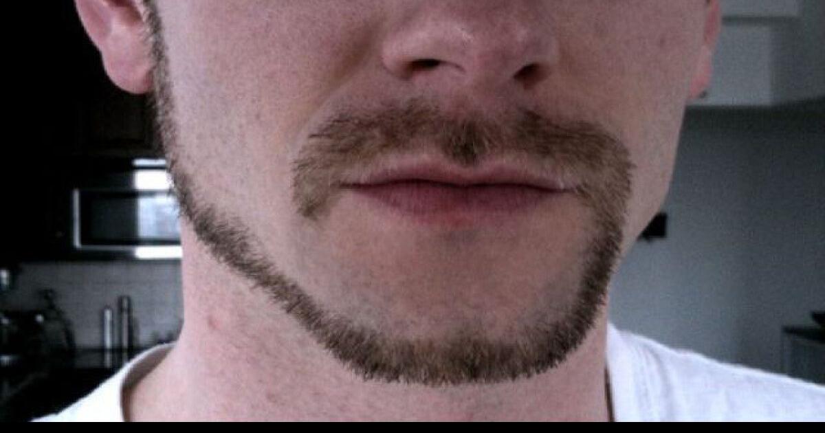Is this the worst facial-hair style ever?