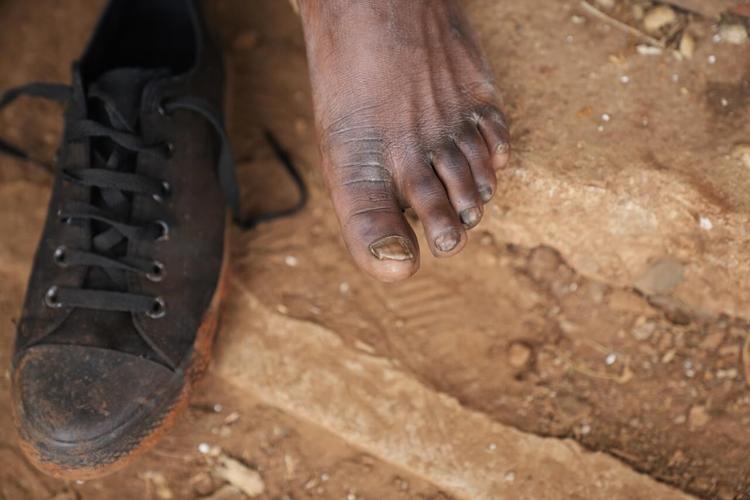 Toes-for-cash hoax reflects Zimbabwe fears of soaring prices
