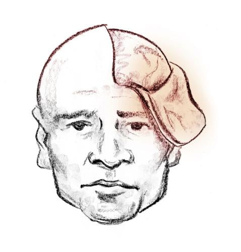 Why head wounds bleed more than other injuries