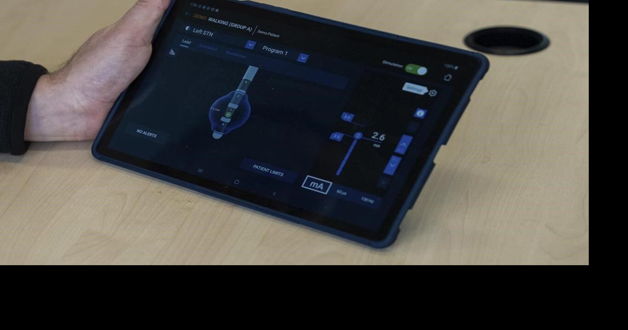 A brain pacemaker helped a woman with crippling depression. It may soon ...