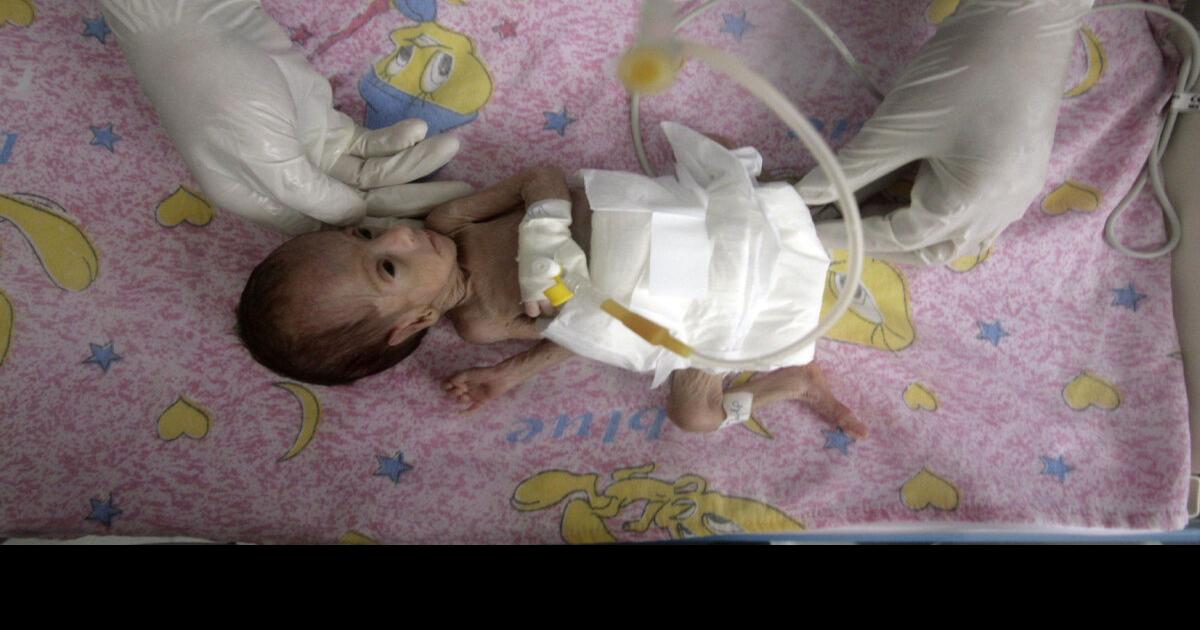 Preemie babies who grow quickly in hospital face fewer learning ...