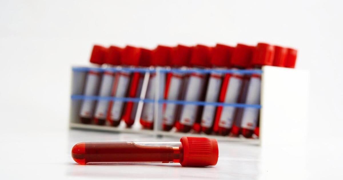 Proposal to lift gay blood ban submitted to Health Canada