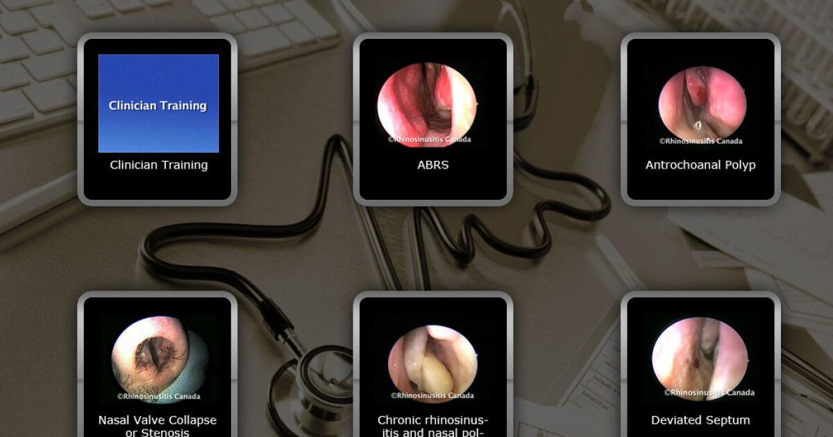 Sinusitis Toolbox App designed to help doctors diagnose sinus issues