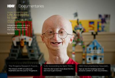 sam progeria