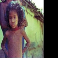 Experts debate destroying last smallpox viruses