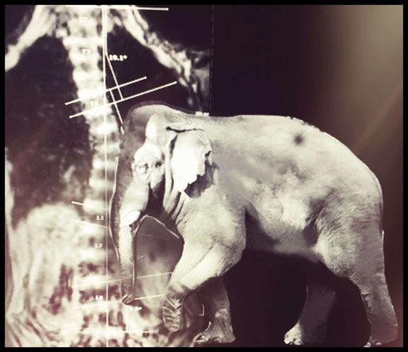 ‘Bent but not broken’: Tina Basich-Haller raises scoliosis awareness ...