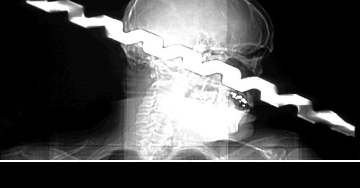 Impaled, in the public eye | News | theunion.com