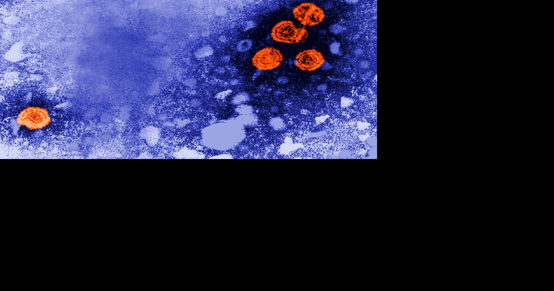 US awards no-bid contract to Denmark scientists studying hepatitis B ...