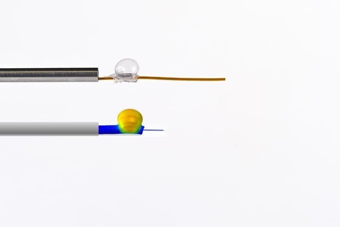 Tiny probe monitors unborn baby’s health inside womb during surgery ...