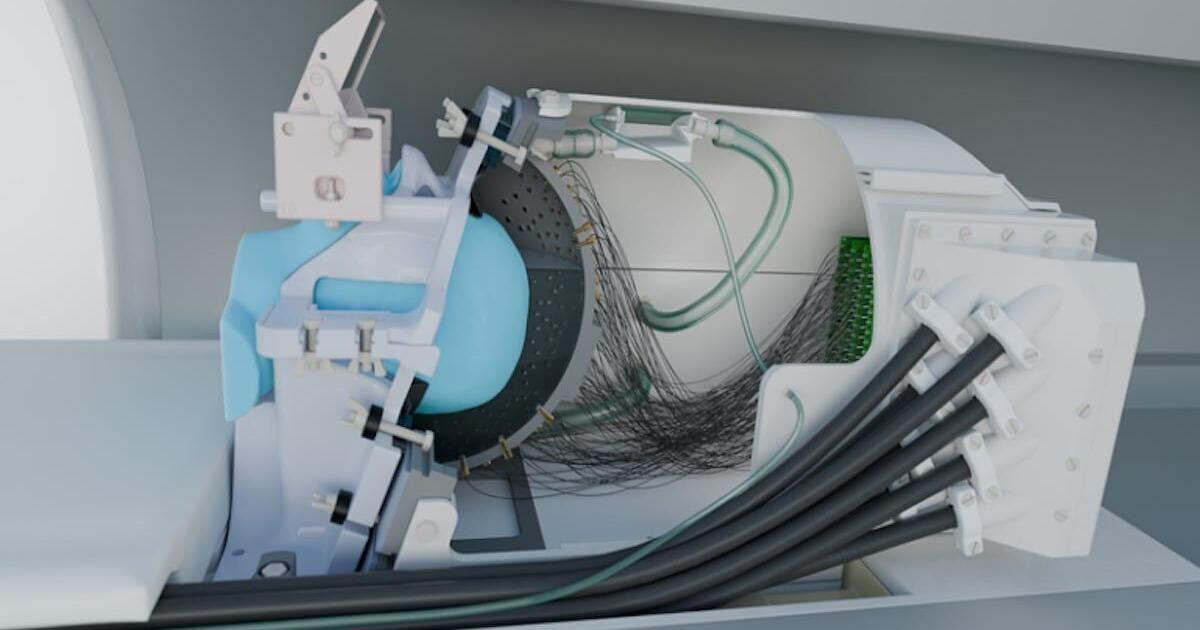 Ultrasound Helmet Provides Surgery-Free Brain Stimulation | News ...