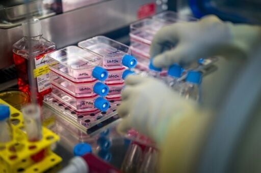 Experts growing new skin for Swiss fire victims | News ...