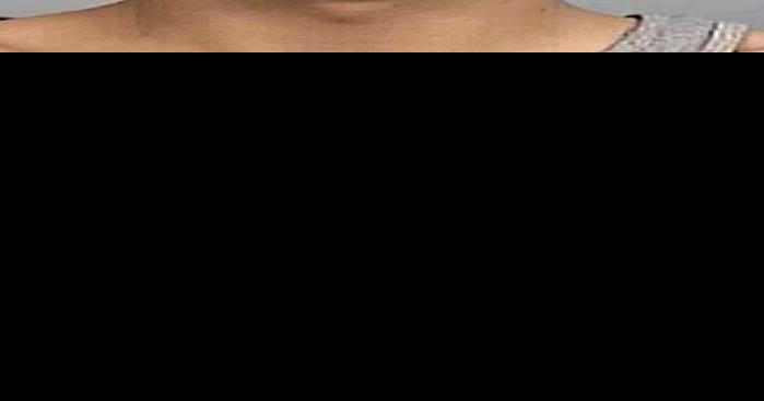 Casper shooting trial continues