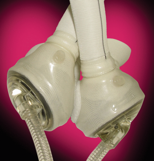 Tucson-based SynCardia exploring options including sale