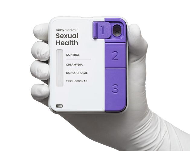 Counties using PCR tests to curb sexually transmitted infections ...