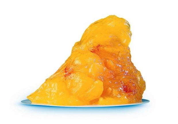 Fit in Tucson: Visualizing fat, and losing it