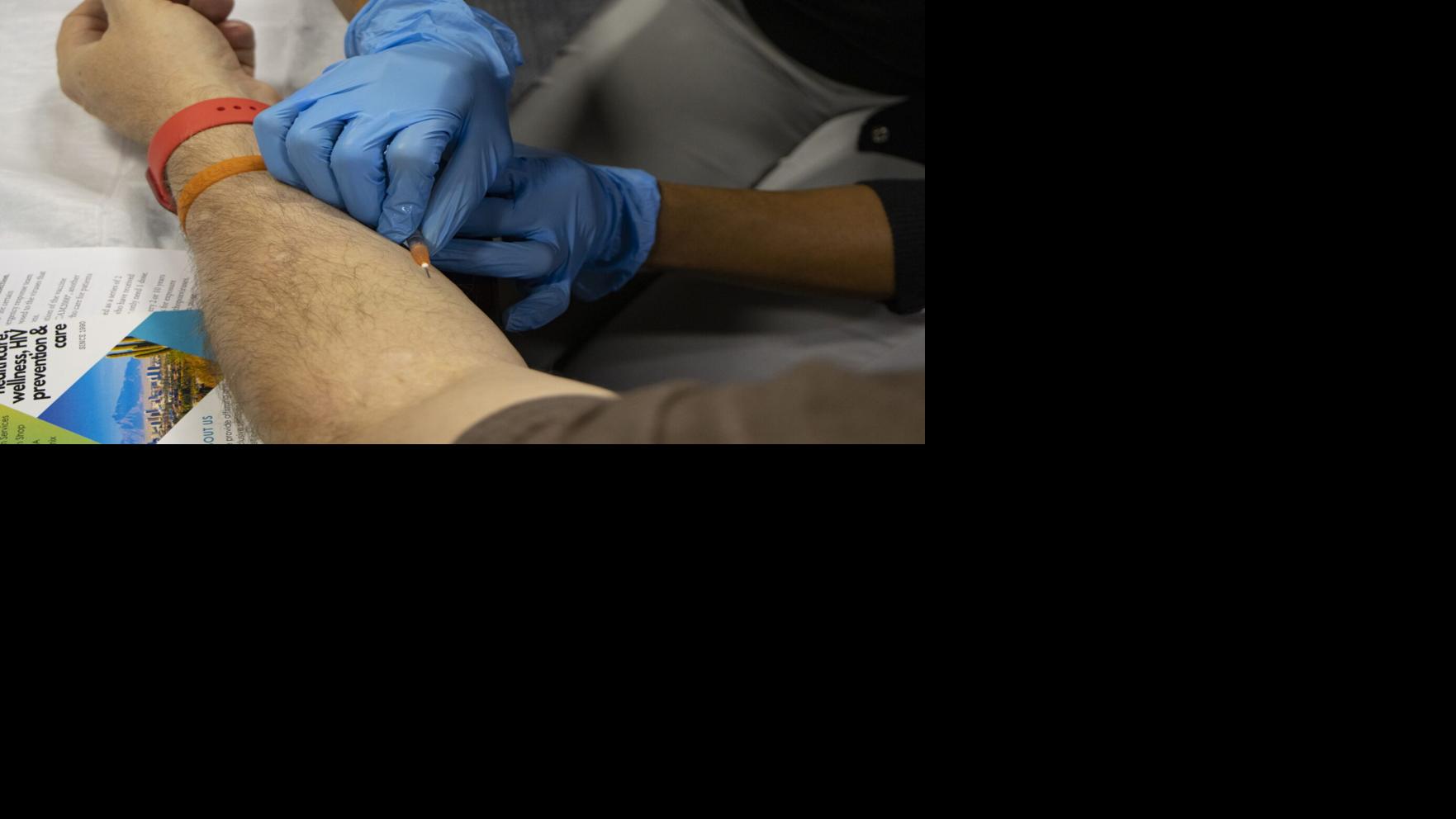 Arizona LGBTQ activists fight stigma around monkeypox