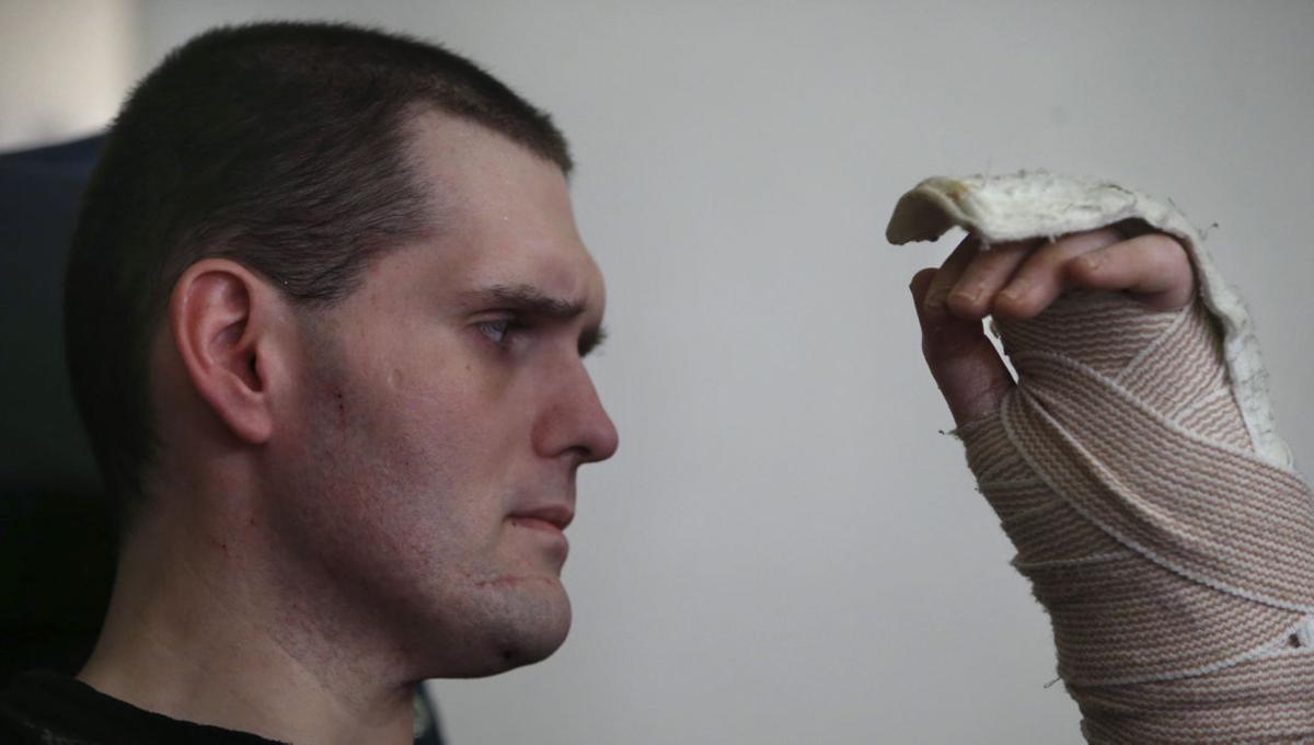 Photos: Erik Schumann survives machete attack