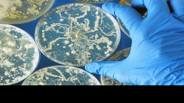 How likely is a fungal apocalypse, like 'The Last of Us'? Plus, stem ...