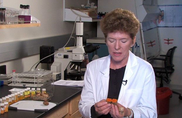 Turmeric studied as stroke preventer