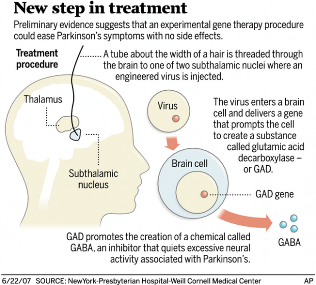New gene therapy promising for Parkinson's