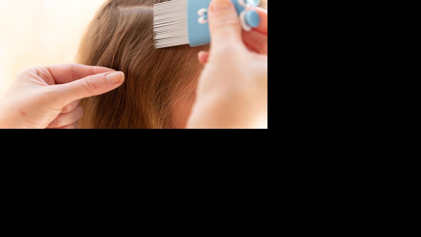 Debunking head lice myths