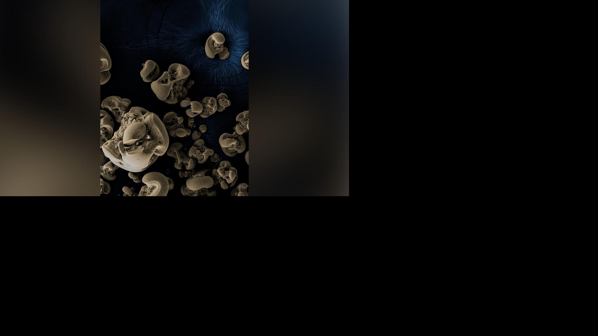 Bacteria that eats metal accidentally discovered by scientists