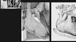 Sistine Chapel's ceiling offers secret anatomy lesson, 2 say