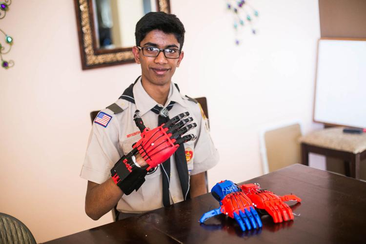 Teen creates prosthetic hands to help around the globe | News ...