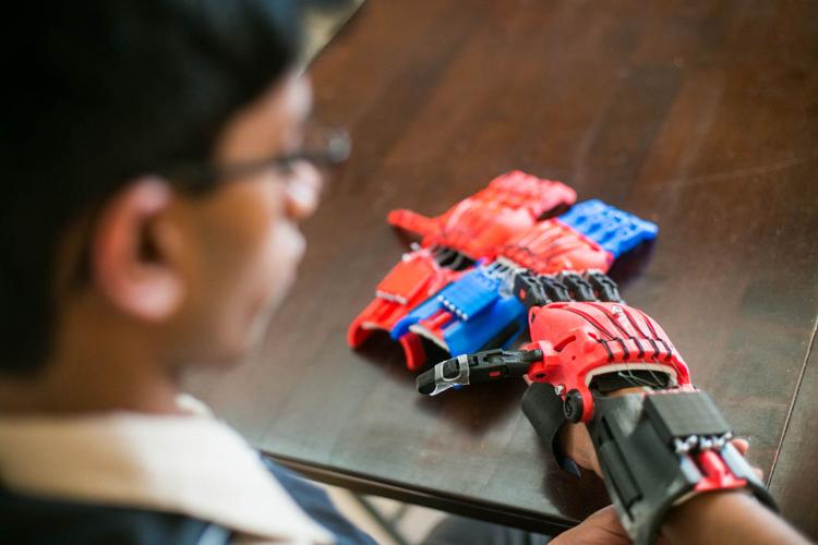 Teen creates prosthetic hands to help around the globe | News ...