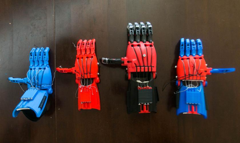 Teen creates prosthetic hands to help around the globe | News ...