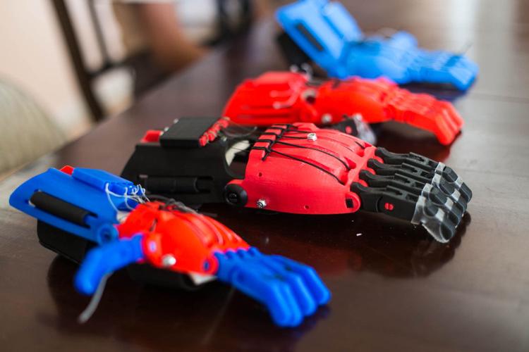 Teen creates prosthetic hands to help around the globe | News ...