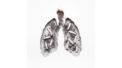 Lung cancer commonly exhibits these signs | Columns | tucsonlocalmedia.com