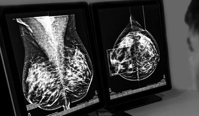 Short-staffed Northern Arizona Radiology pauses mammogram readings ...