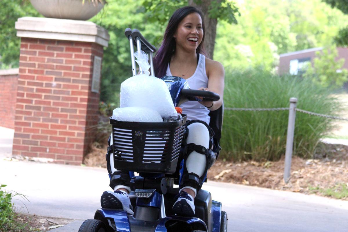The Auburn gymnast whose injury went viral is refusing to let adversity ...