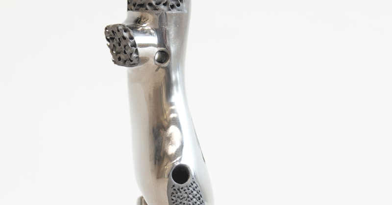 CRMC surgeon performs rare 3d-printed fibula implant procedure | Health ...