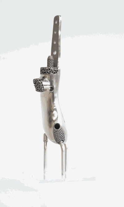 CRMC surgeon performs rare 3d-printed fibula implant procedure | Health ...