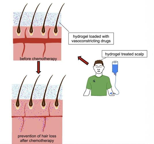 Shampoo-like gel may help chemo patients keep hair | Health ...