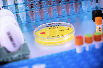 Bird Flu Tests Are Hard To Get. So How Will We Know When To Sound the ...