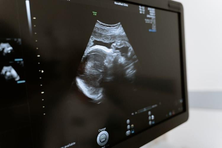 Wearable patch offers 24/7 monitoring for high-risk pregnancies ...