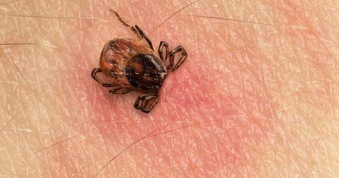Cover Story: Tick-related ER visits surge this spring | Cover Story ...