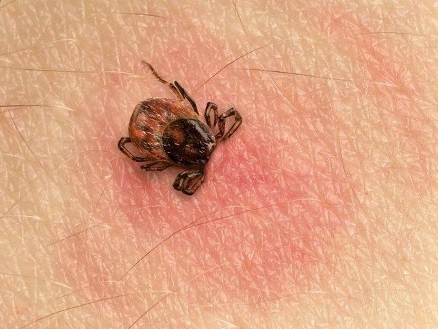 Cover Story: Tick-related ER visits surge this spring | Cover Story ...