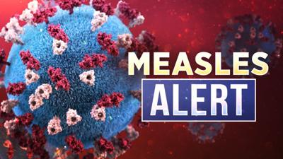 Confirmed measles case in Bryan County | News | wfxg.com