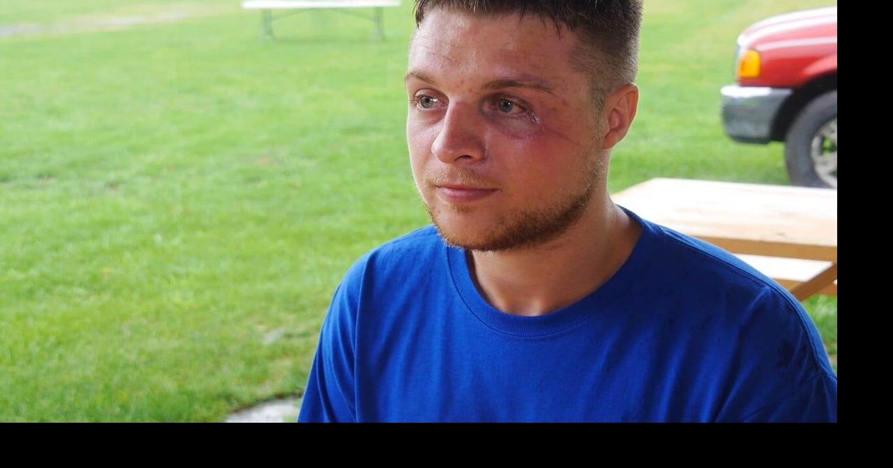 Candor Man Survives Violent Attack, Seeks to Help Other Trauma Victims ...